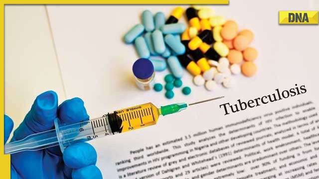 Nikshay Mitra: Government initiative to aid TB patients, destigmatize ...