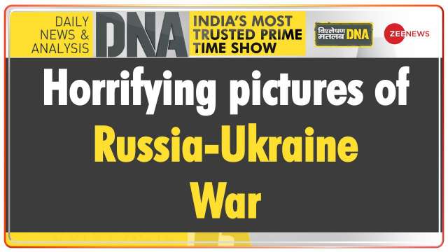 DNA | Horrifying pictures of Russia-Ukraine War