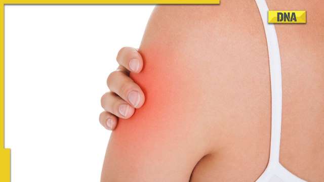 What is Covid arm? Here's everything you need to know What is Covid arm? Here's everything you need to know