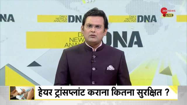 DNA | Know all about hair transplant