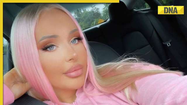 Meet Jazmyn Forest Who Spent Over Rs 82 Lakh To Look Like Real Life